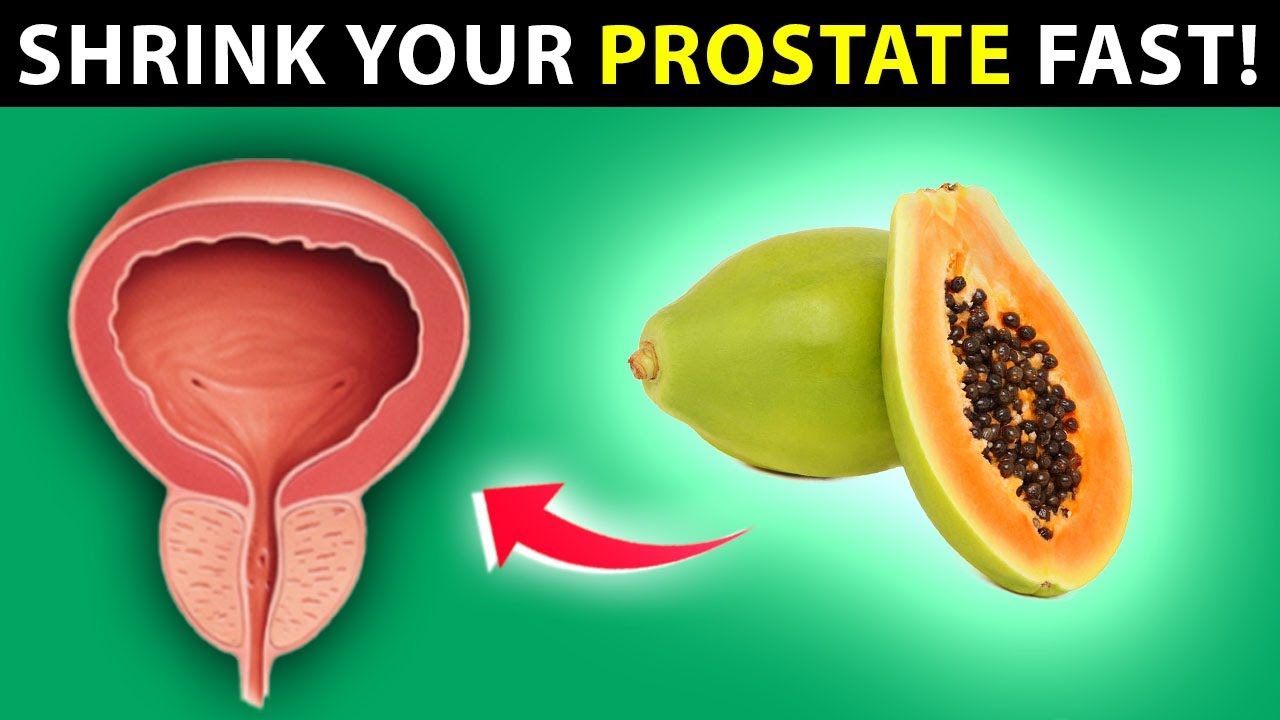 PROSTATE WARNING! Eat These Foods to SHRINK ENLARGED PROSTATE - YouTube