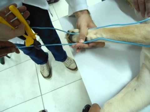 Muleta-Aparelho de Thomas - YouTube