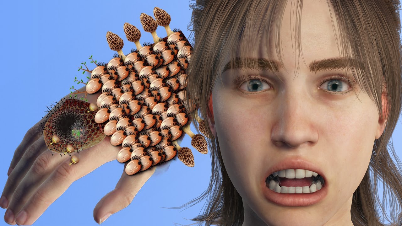 ASMR Remove Maggots & Worm Infected Hand | Severely Injured Animation ...