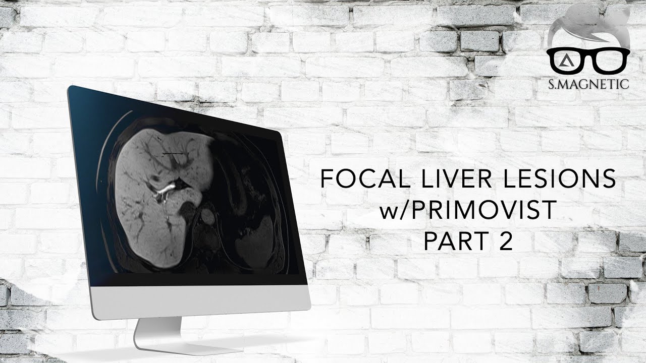 FOCAL LIVER LESIONS w/PRIMOVIST PART 2 - YouTube
