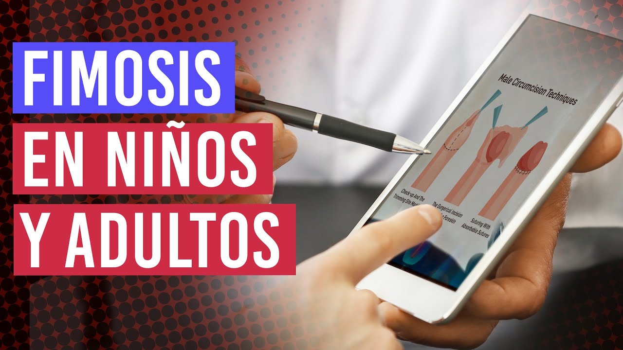 ¿Cómo afecta la fimosis a niños y adultos? - YouTube