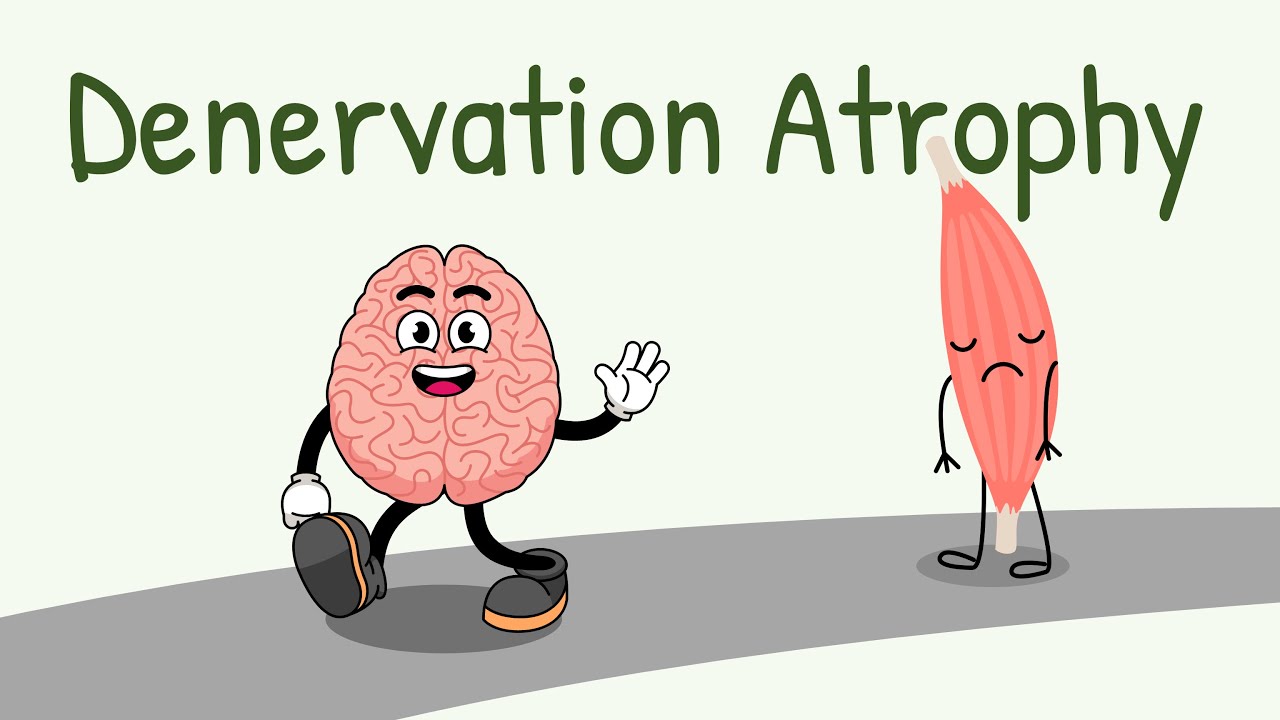 When the Brain BREAKS UP with Muscles... || Denervation Atrophy of ...
