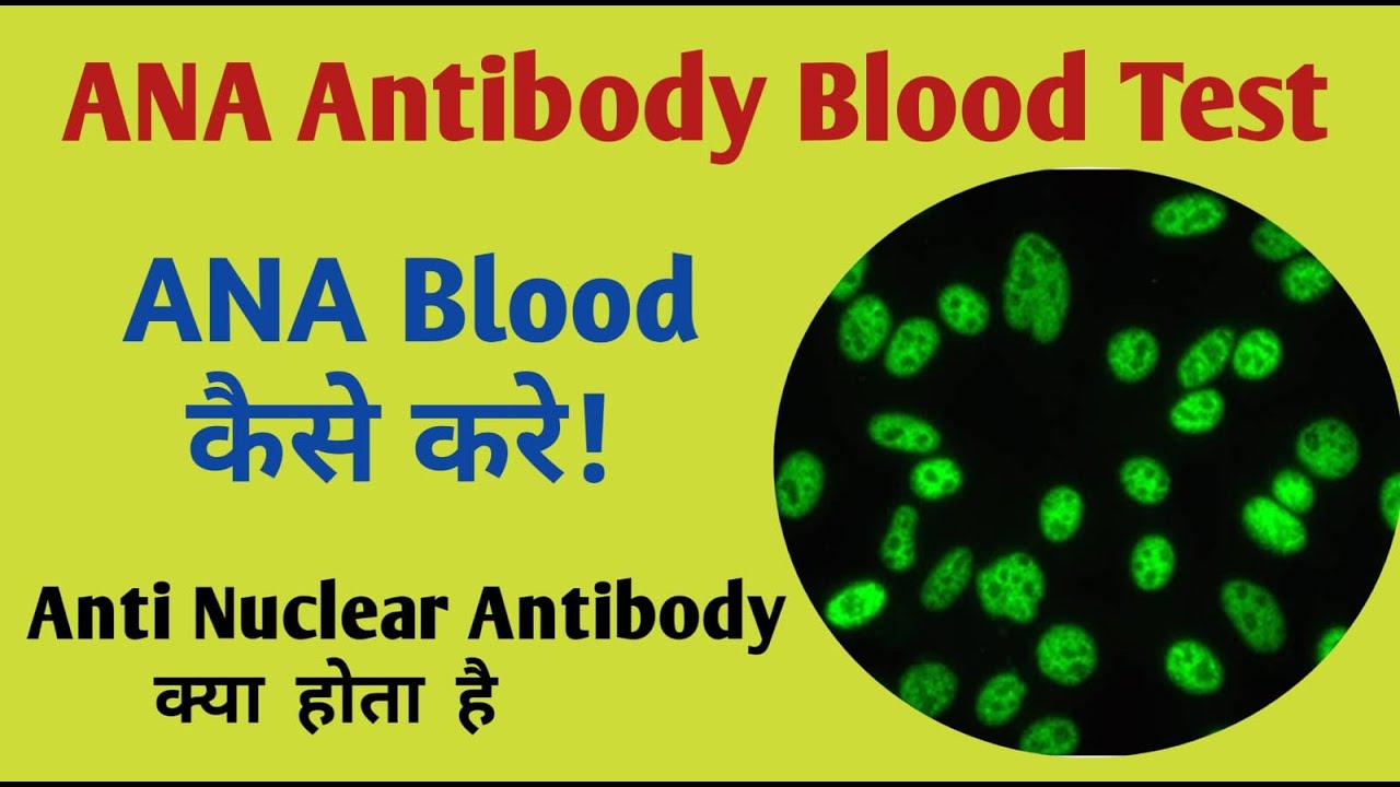 ana antibody I antinuclear antibody - YouTube