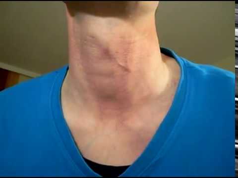adams apple / veiny neck