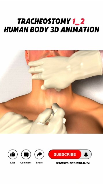 Tracheostomy 1_2 - Human Body 3D Animation #shorts #human #body | learn ...
