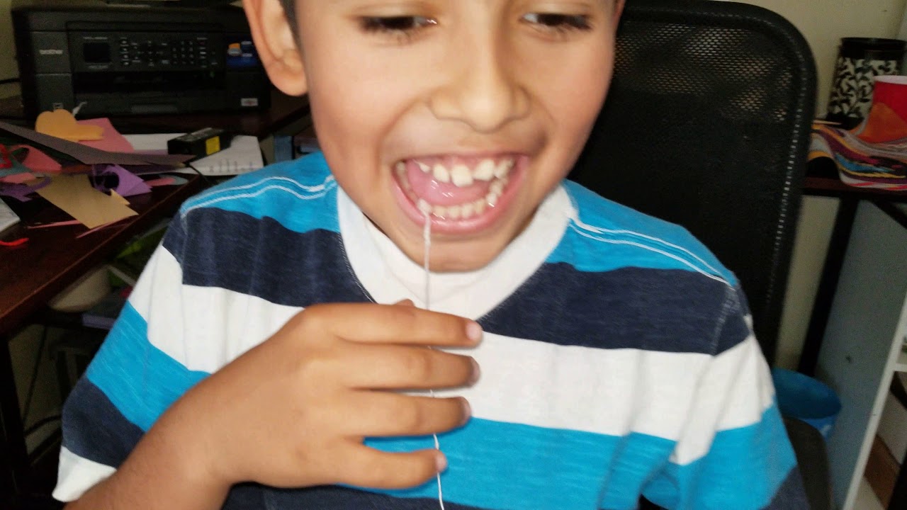 Coolest way to yank out a loose tooth with a lego - YouTube