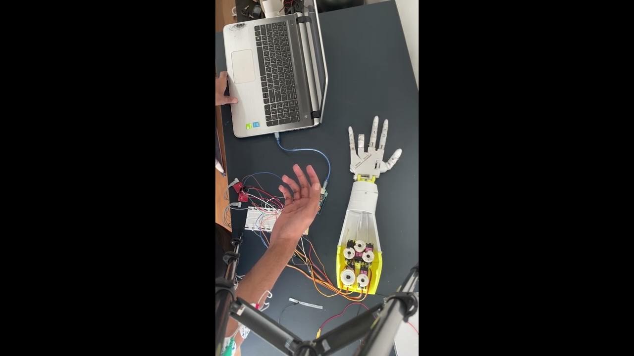 P8: EMG-Prosthetic Hand - YouTube