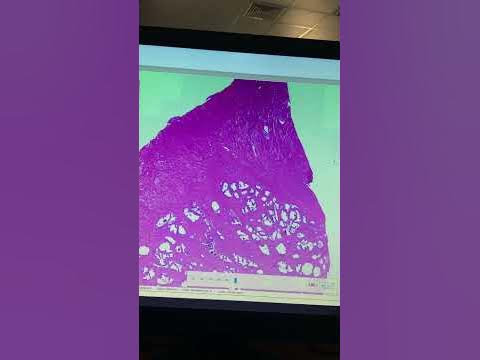 Lab 2 part 2 anatomy - YouTube