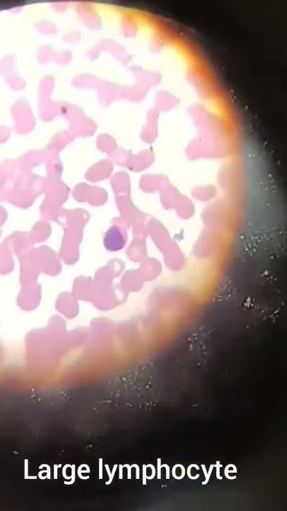 Microscopic View Of Neutrophil And Lymphocyte Youtube