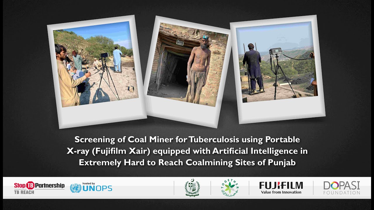 Screening of Coal Miners in Chakwal through portable x-ray (FujiFilm ...