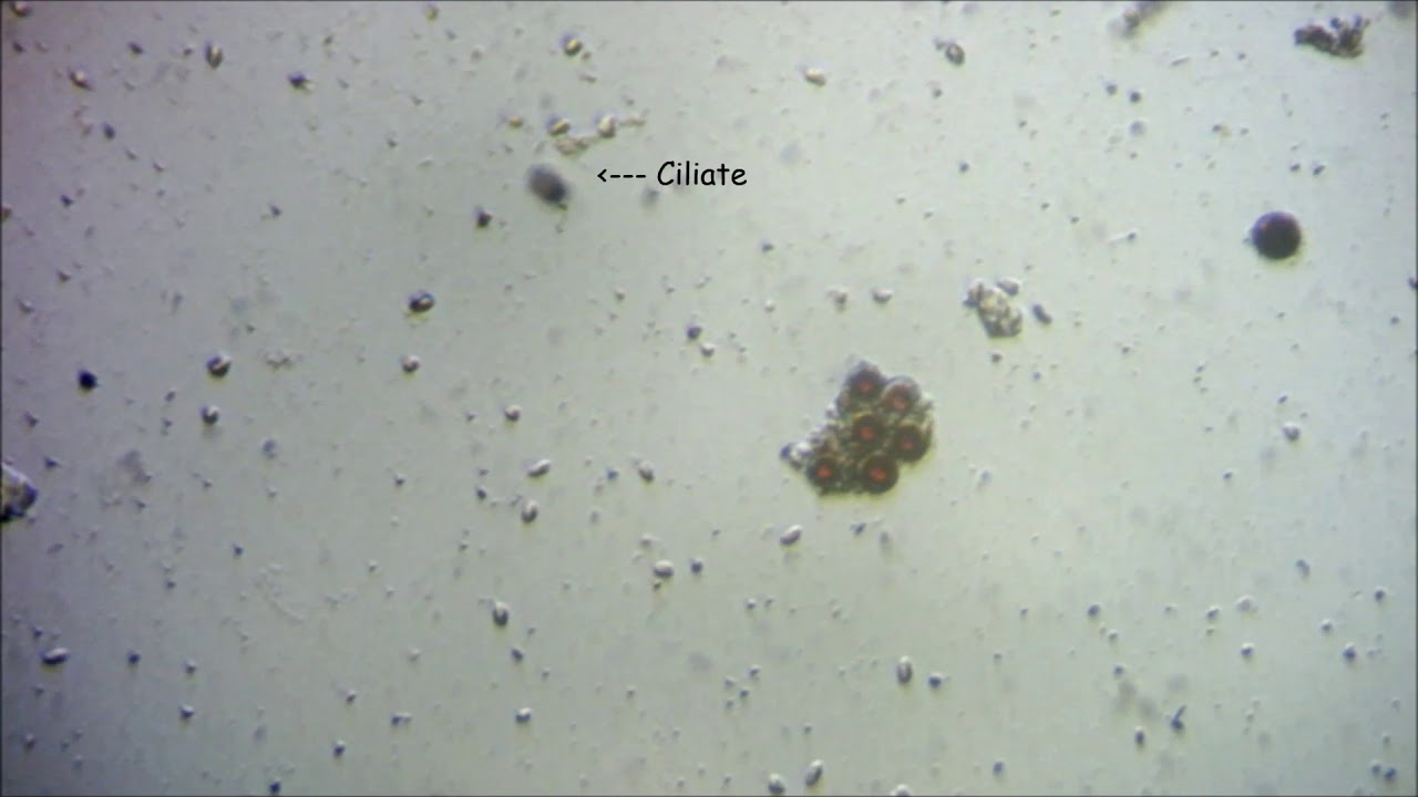 Rainwater under the microscope - YouTube