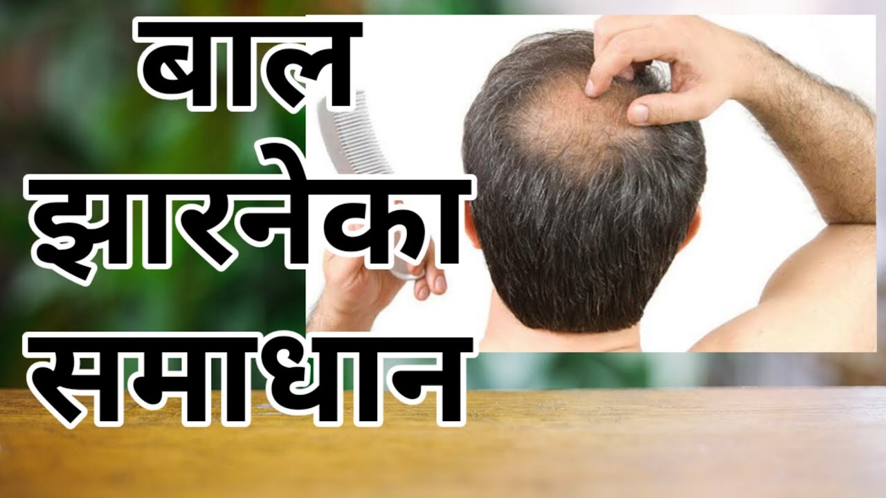 Hair Fall Solutions Hair Fall Homeopathic Medicine बाल झारना कैसे