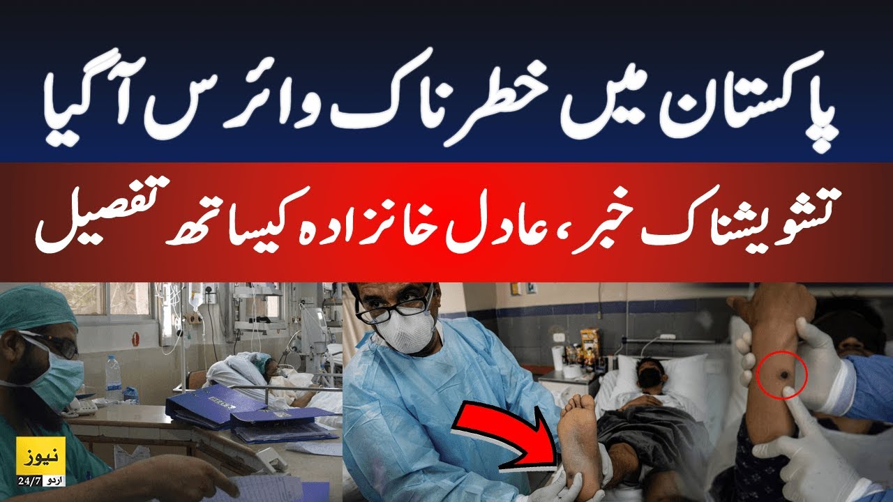 First case of a dangerous virus reported in Pakistan in 2024 - Details ...