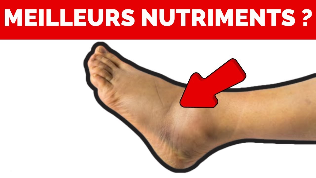 Top 5 des nutriments pour réduire l’enflure des pieds et des jambes ...
