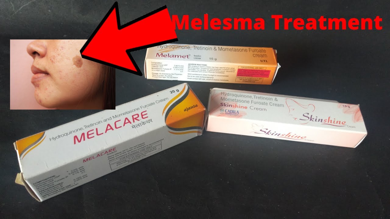 Melesma Treatment | Skinshine Cream Vs Melacare Cream Vs Melamet Cream ...