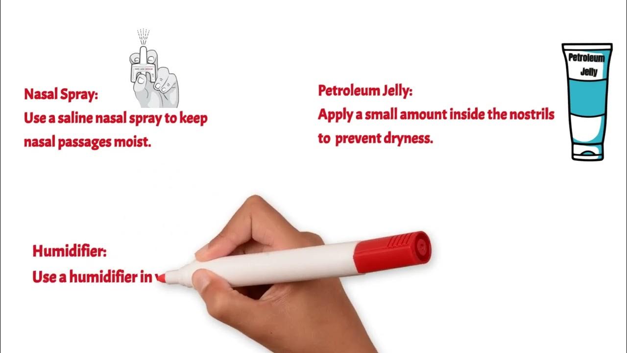 Nosebleeds/Epistaxis| Understanding Nose Bleeds: Causes, Prevention, and Treatment - YouTube