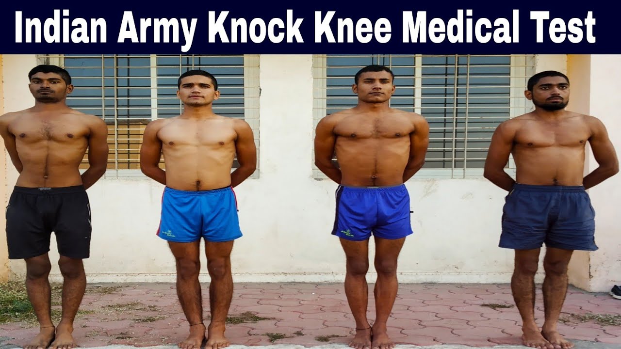 Knock Knee Medical Test Nd Exercises YouTube knock-knee-medical-test-nd-exercises-youtube