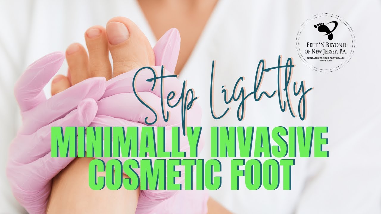 Step Lightly: The Advantages of Minimally Invasive Cosmetic Foot - YouTube