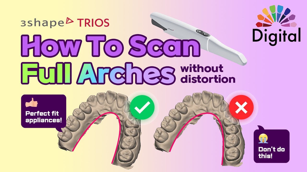 Digital Highlight - Full Arch Scanning Tips For Perfect Appliance Fit ...