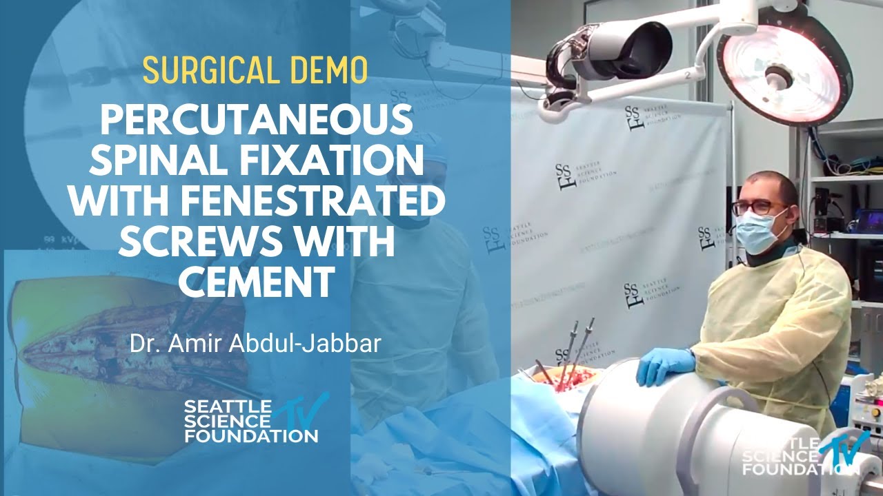 Percutaneous Spinal Fixation with Fenestrated Screws with Cement - Amir ...