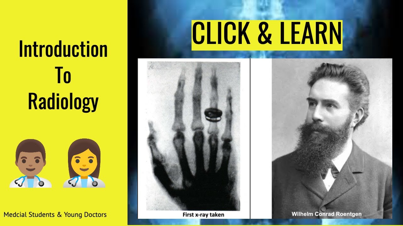 👨🏽‍⚕️Introduction to Radiology: Conventional Radiography - YouTube