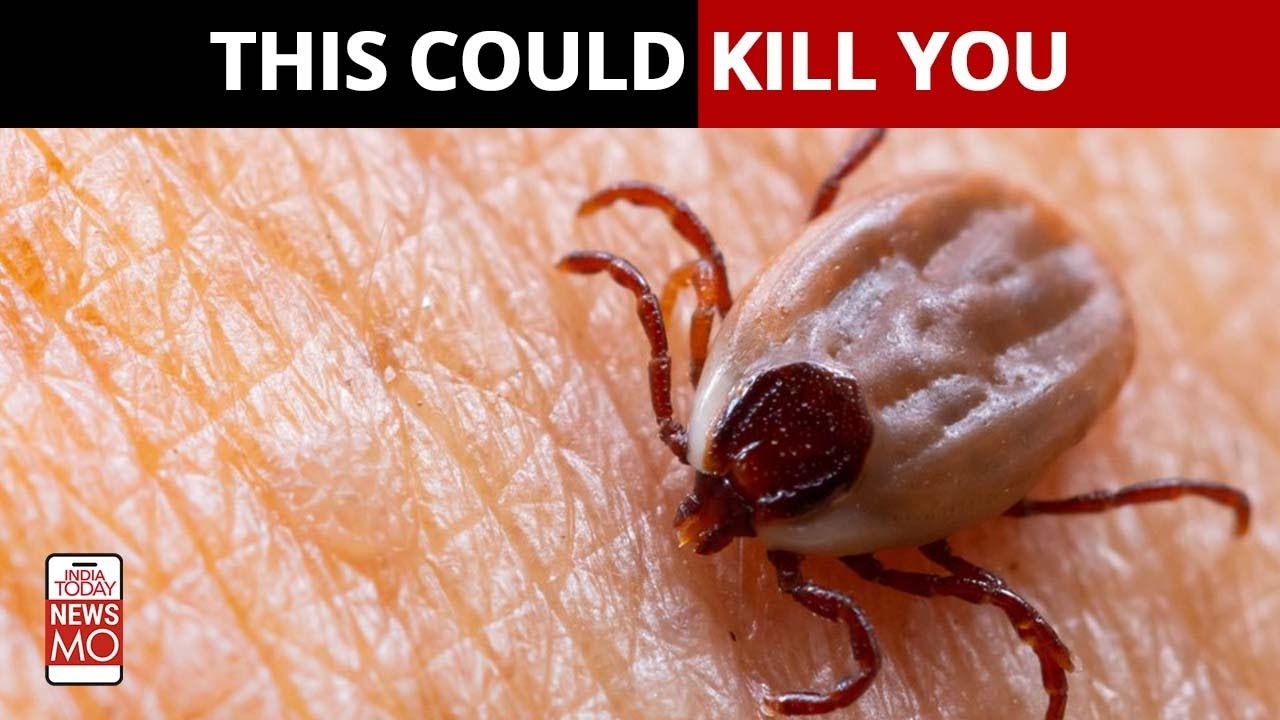A Deadly Viral Infection Is Posing A Problem In U.S. All About The Tick ...