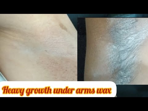 heavy growth under arms wax..#trending #easy #underarms - YouTube