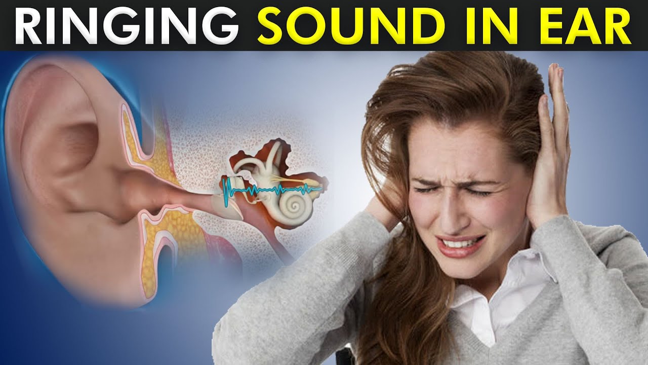 Tinnitus Unveiled: Causes, Effects, and Solutions - YouTube