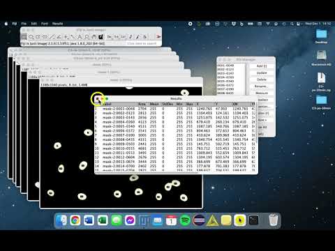 ImageJ/Fiji - Segmentation Part 6: Measuring - YouTube
