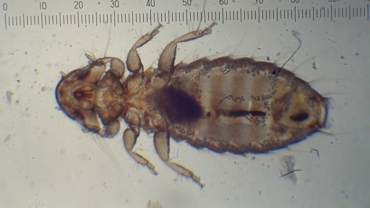 Menacanthus - YouTube