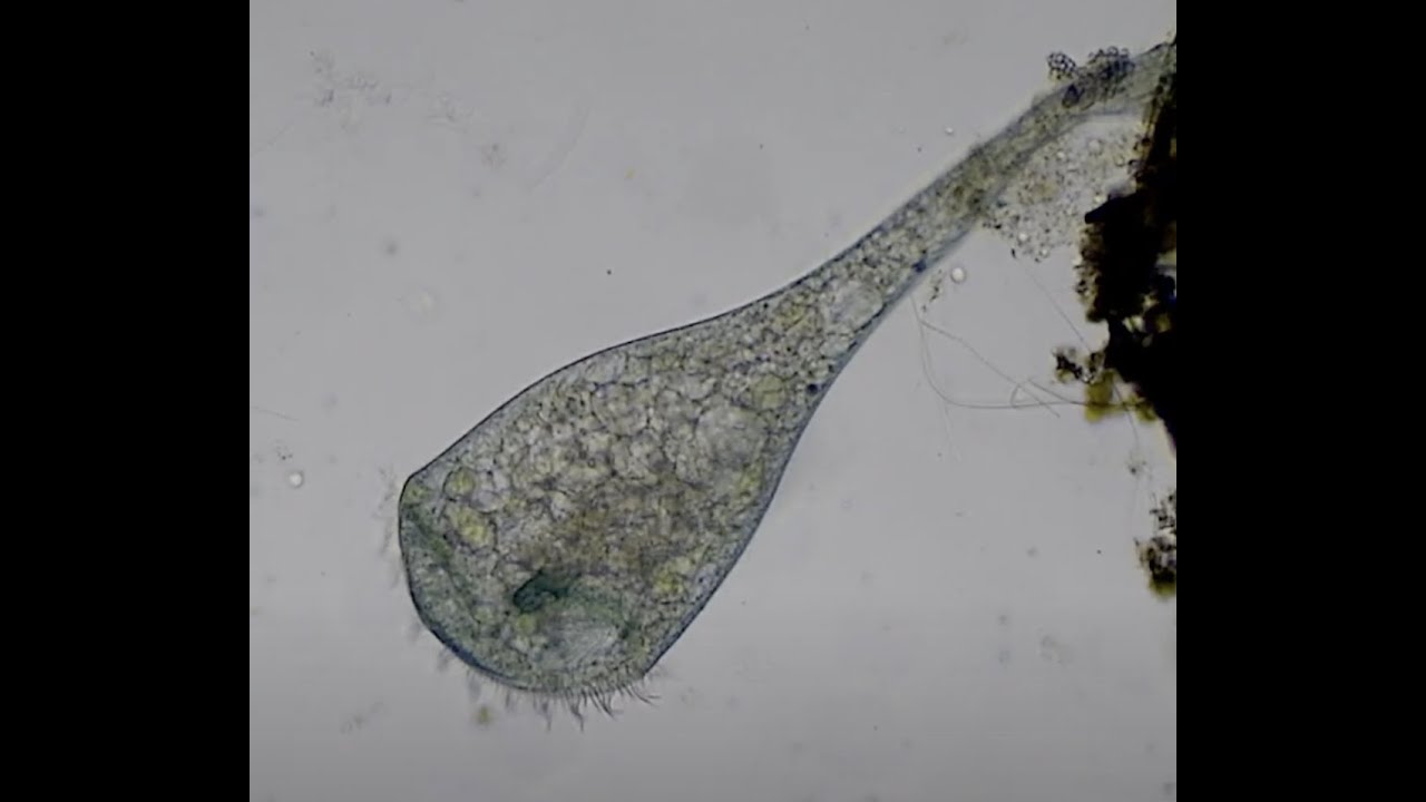 Stentor Under Microscope 400x