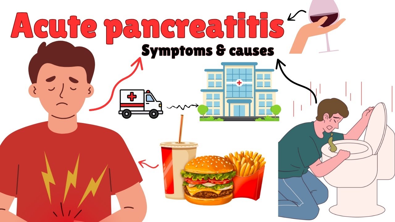 What you really need to know about Acute Pancreatitis: ACUTE ...