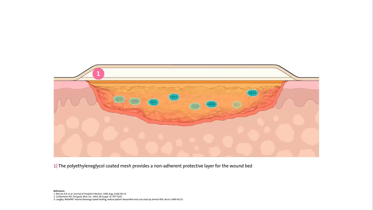 INADINE Mode of Action - YouTube