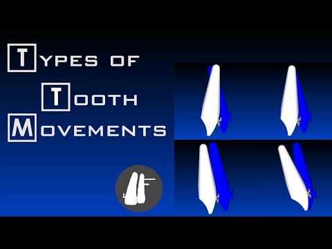 Types Of Tooth Movement | Essential Biomechanics - YouTube