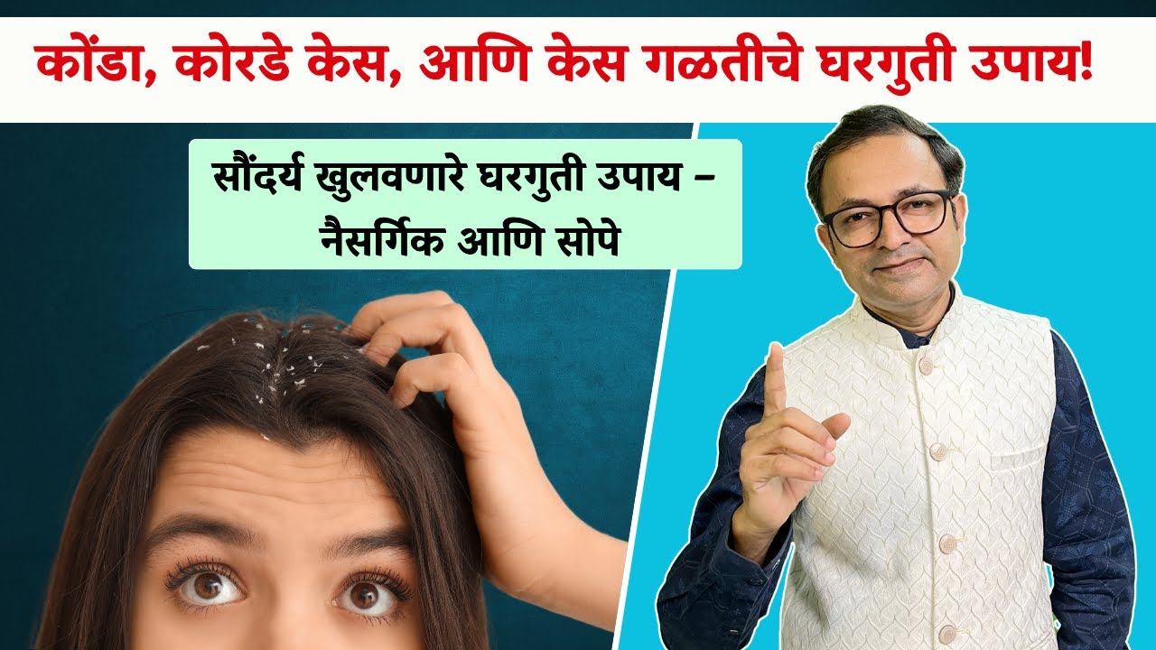 कोंडा, कोरडे केस, आणि केस गळतीचे घरगुती उपाय! By Vaidya Atul Kale ...