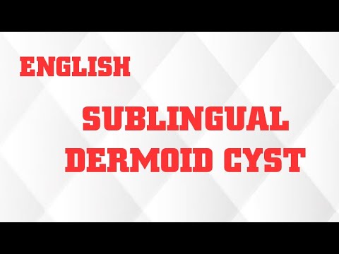 SUBLINGUAL DERMOID CYST IN ENGLISH/INTRODUCTION/TYPES/CLINICAL FEATURES ...