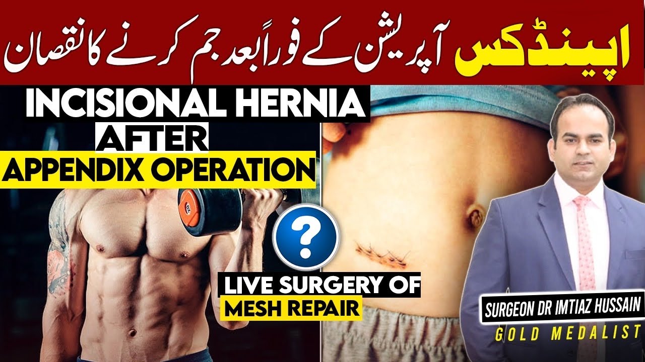 Mesh Repair of Incisional Hernia after Appendix Operation | Stepwise ...