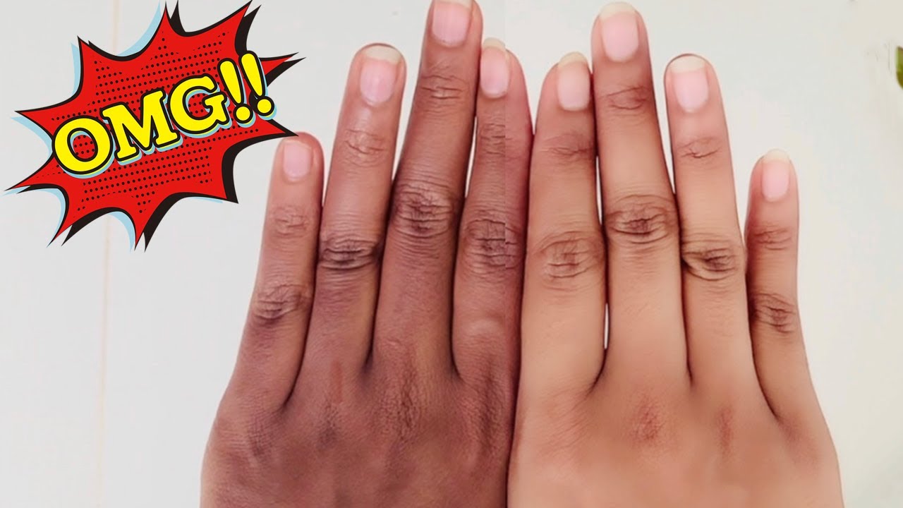 Hand Whiting lotion Natural hand Whitening Formula | Hand Whitening ...