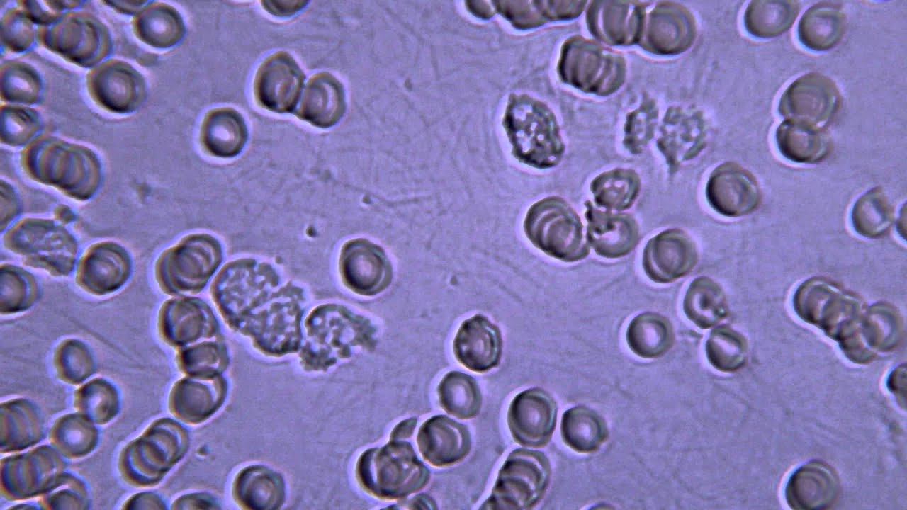 white blood cell wbc clumping 1/3 - timelapse photos - YouTube