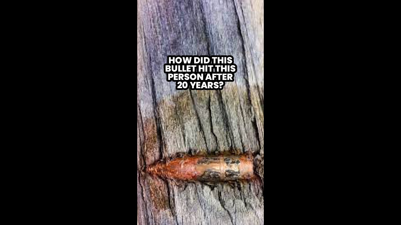 How did this bullet hit this person after 20 years? - YouTube
