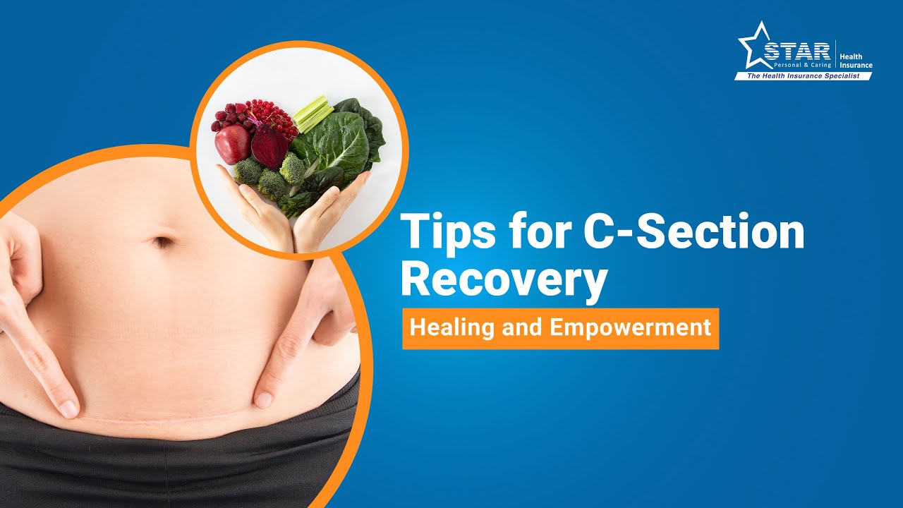 Star Health Insurance | C-Section Recovery Tips | English - YouTube