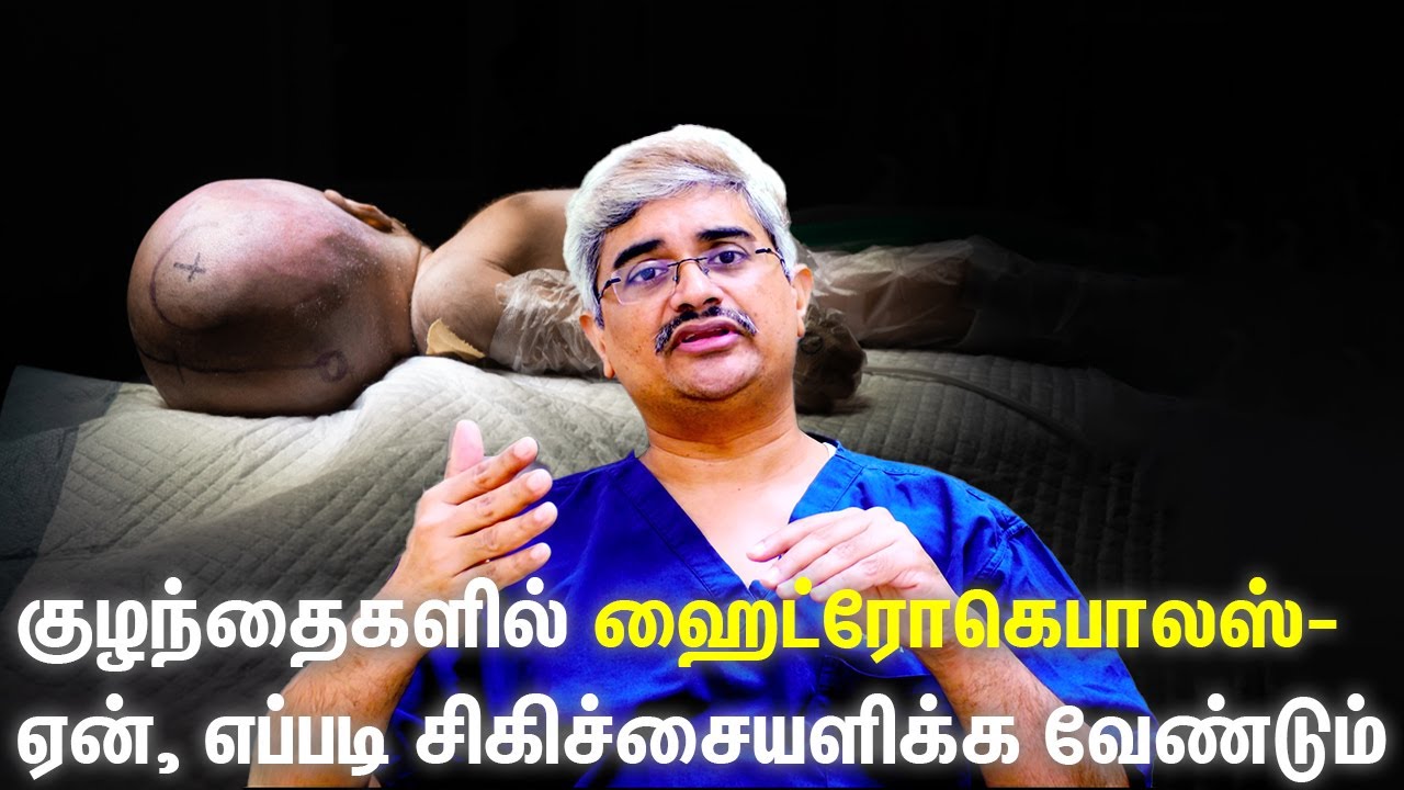 Hydrocephalus in children- Why and how should be Treated Dr.Roopesh ...