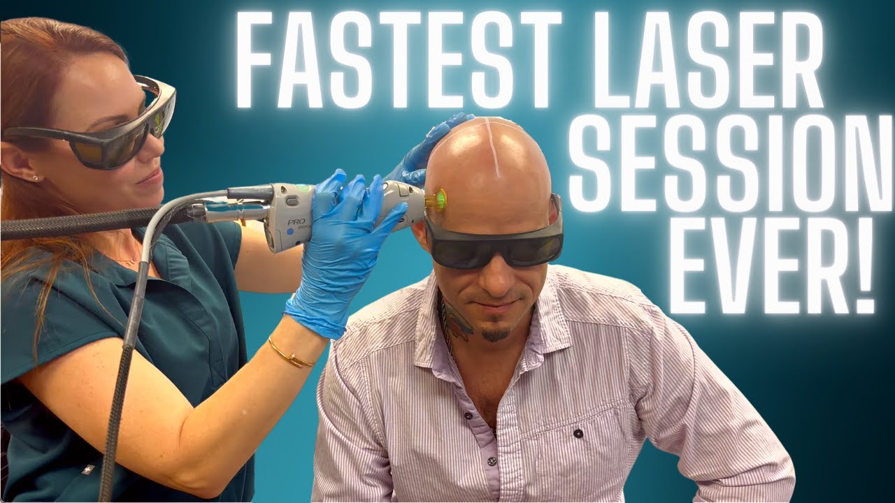 FASTEST SCALP LASER HAIR REMOVAL EVER: UNCUT SESSION - YouTube