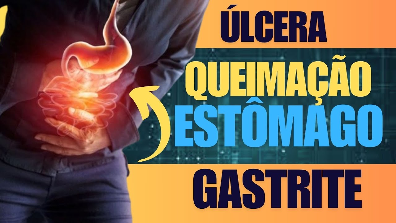 Queimação no estômago, gastrite e úlcera - Espinheira Santa! - YouTube