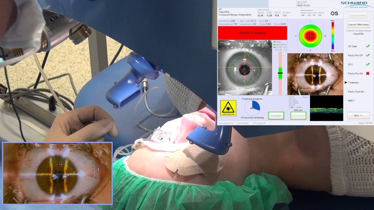 TransPRK SmartSurface - YouTube