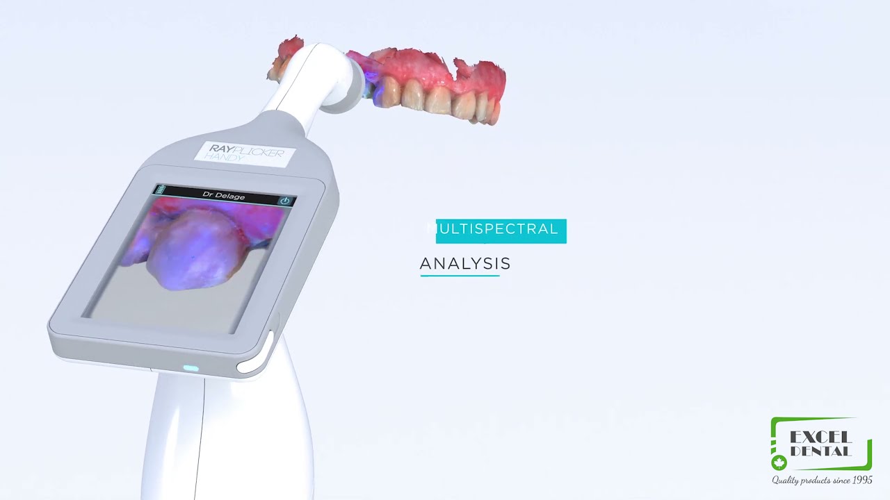 Digital Shade Scanner - RAY PLICKER HANDY Easy Shade - YouTube