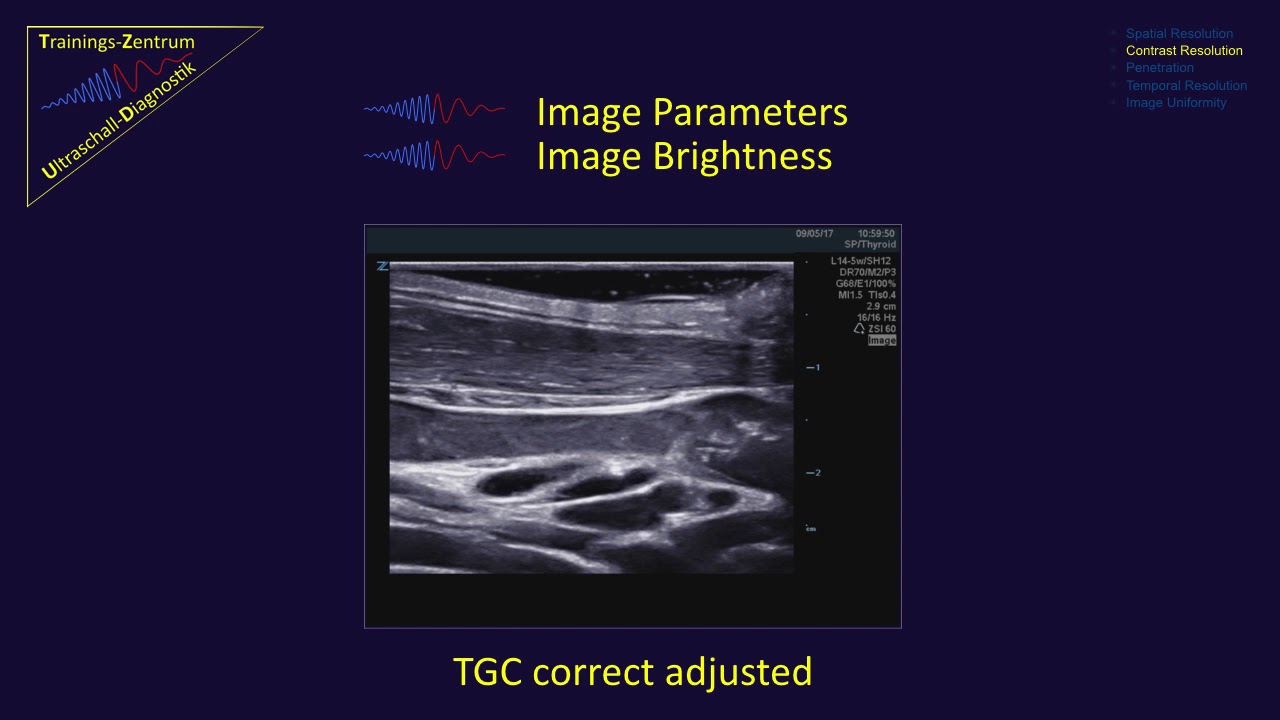 Contrast resolution in ultrasound diagnostic 02 - YouTube