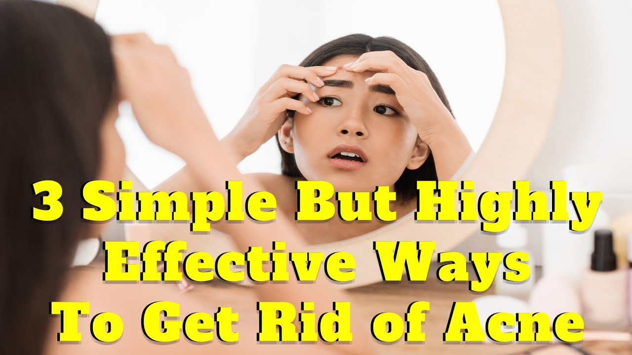 3 Simple But Highly Effective Ways to Get Rid of Acne - YouTube