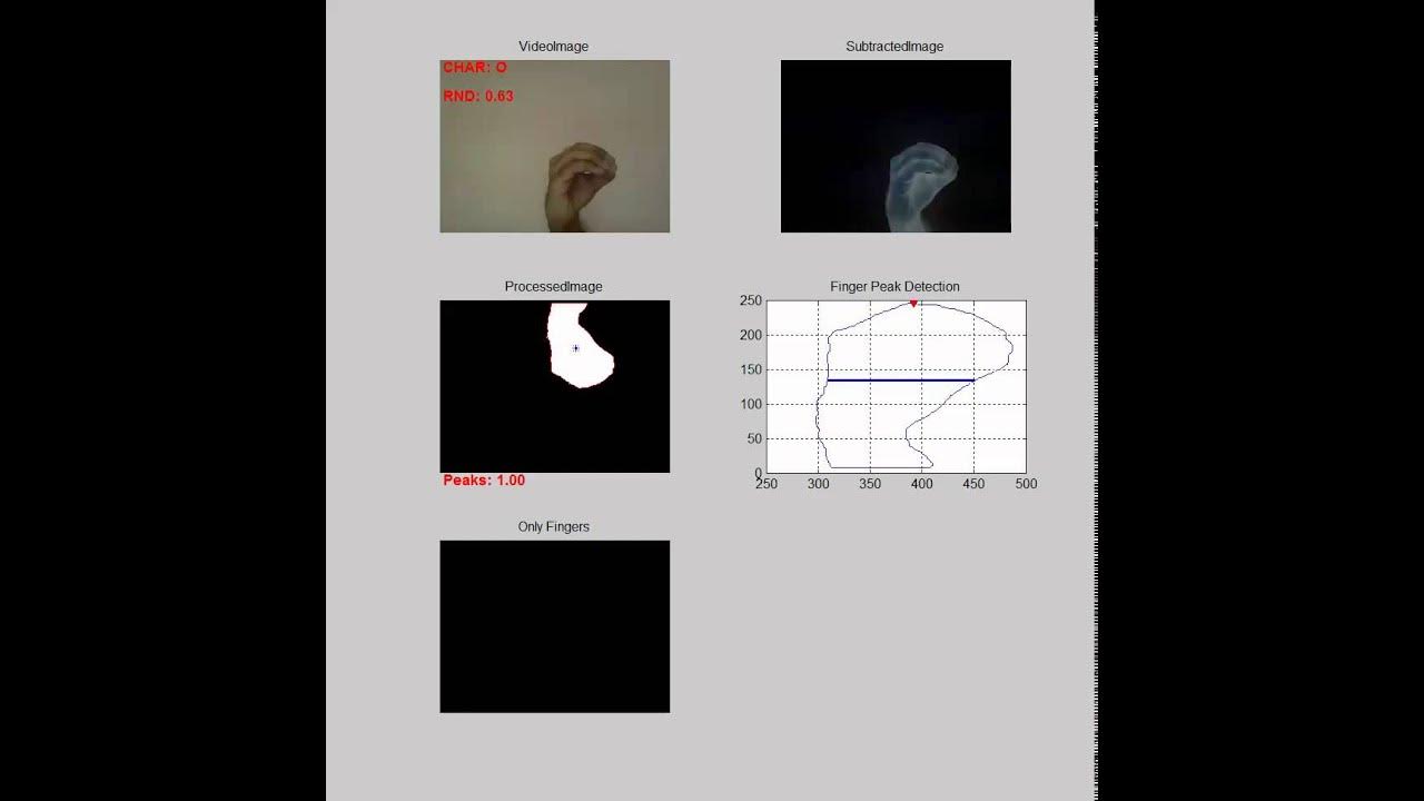 Realtime Hand Gesture Recognition using Matlab - YouTube