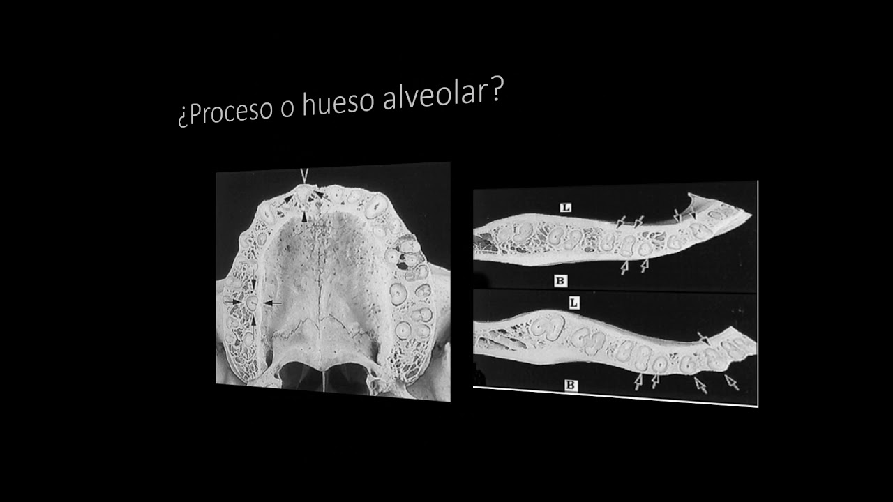 Cápsula anatómica 4: Proceso alveolar - YouTube